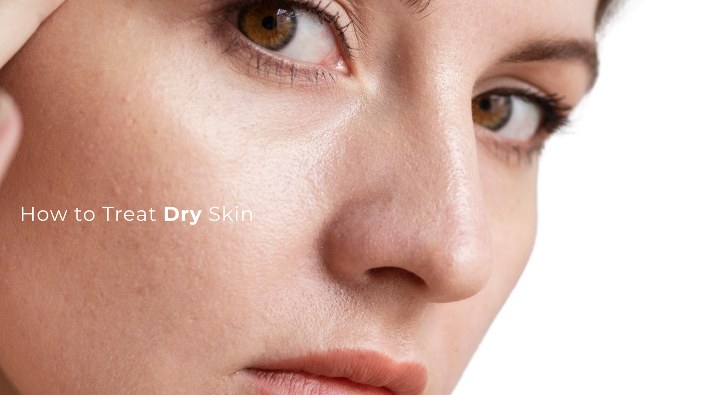 How to Treat Dry Skin: A Comprehensive Guide – Long Story